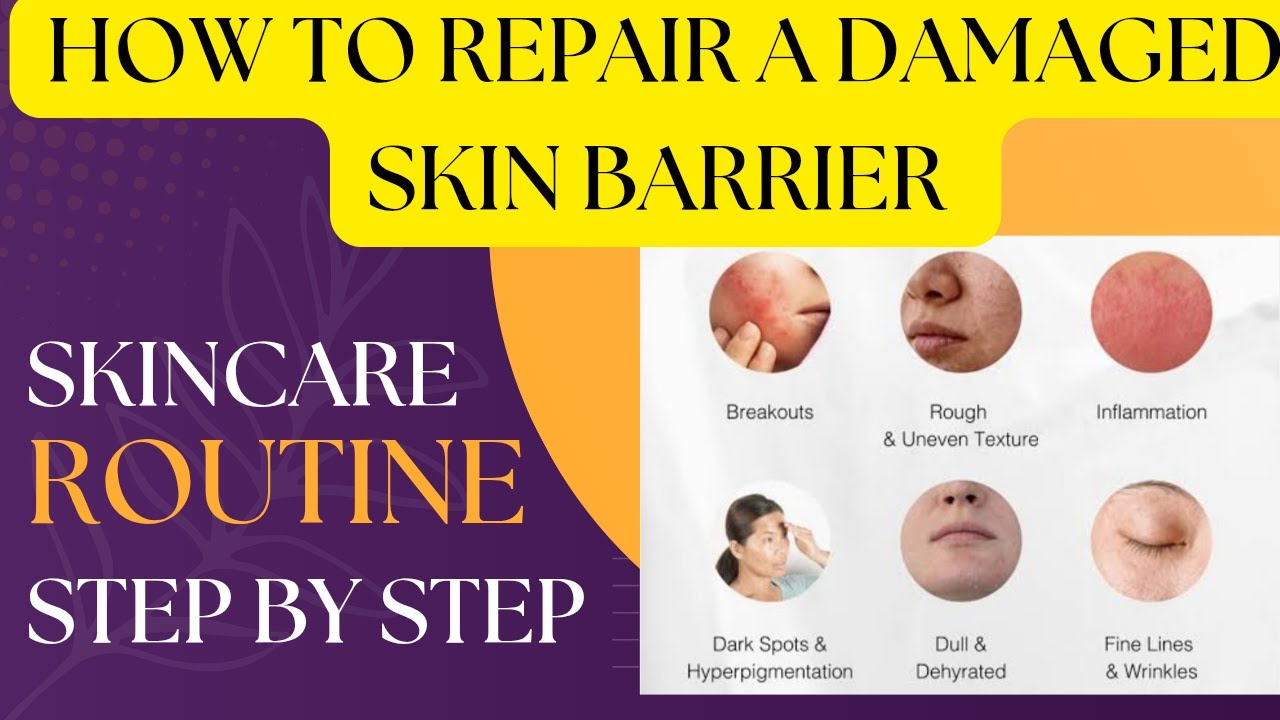 How to Repair a Damaged Skin Barrier FAST! Best Products & Routine for ...
