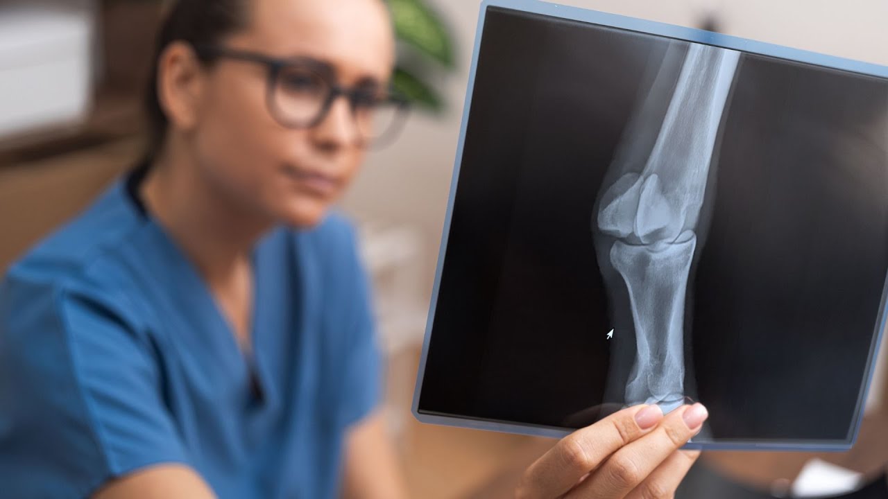 Mastering Equine Radiography: Essential Tips and Checklist for Vets 🐴🩻 ...