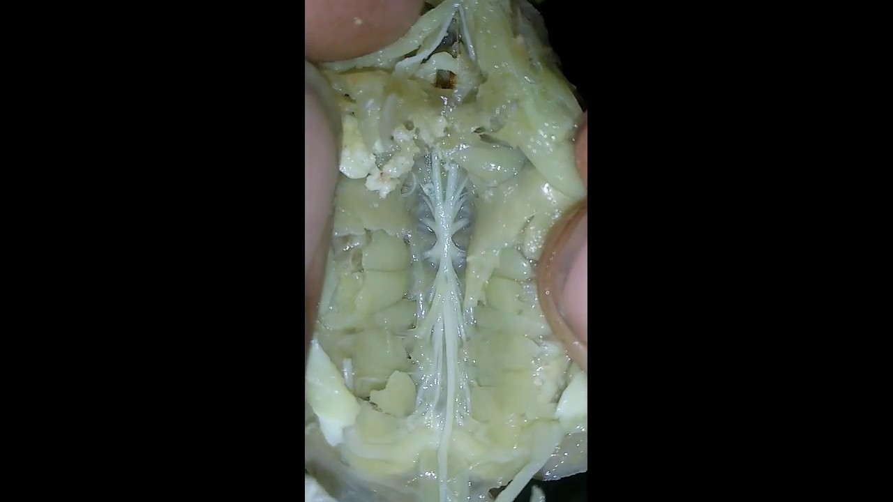 ||Dissection of Prawn|| Nervous system__ - YouTube