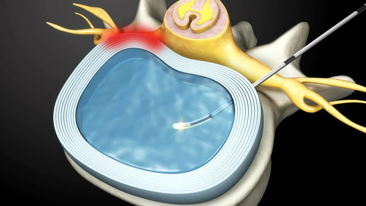 intocare lb text - YouTube