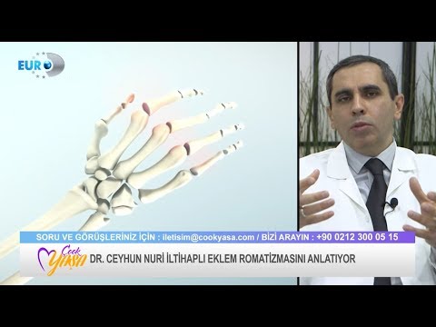 ROMATOİD ARTRİT ( İLTİHAPLI EKLEM ROMATİZMASI ) NEDİR- TEDAVİSİ - DR. CEYHUN NURİ - EURO D