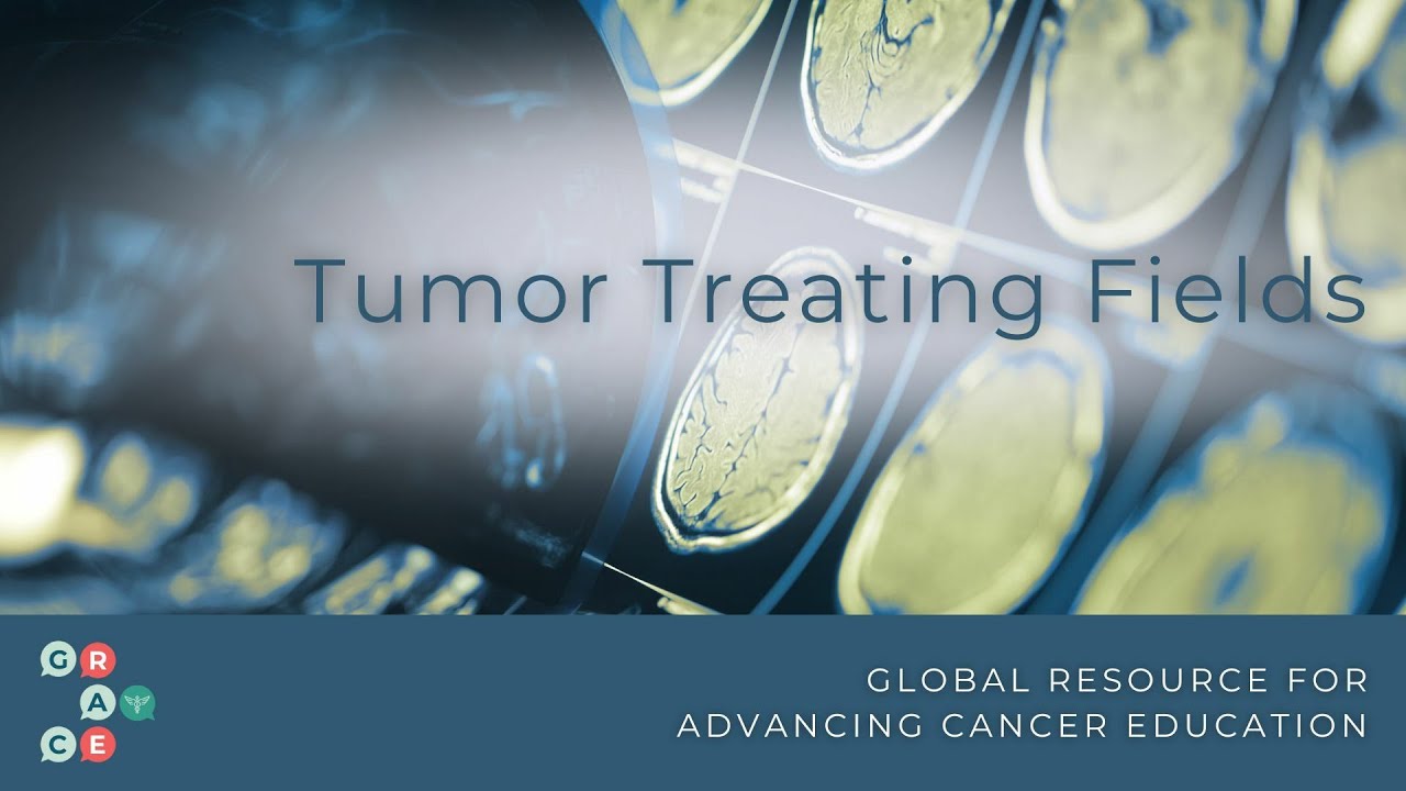 Tumor Treating Fields: An Overview- Mesothelioma and Glioblastoma, 2024 - YouTube