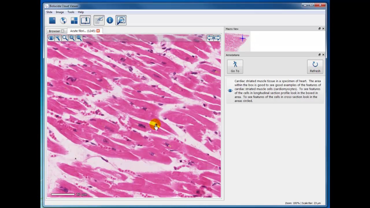 Module 2 Heart for Cardiac Muscle - YouTube