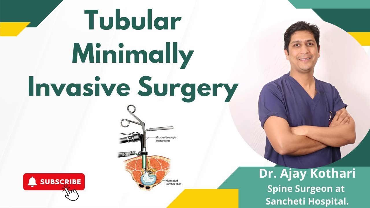 Tubular Minimally Invasive Surgery | Myths & Facts | Dr. Ajay Kothari # ...