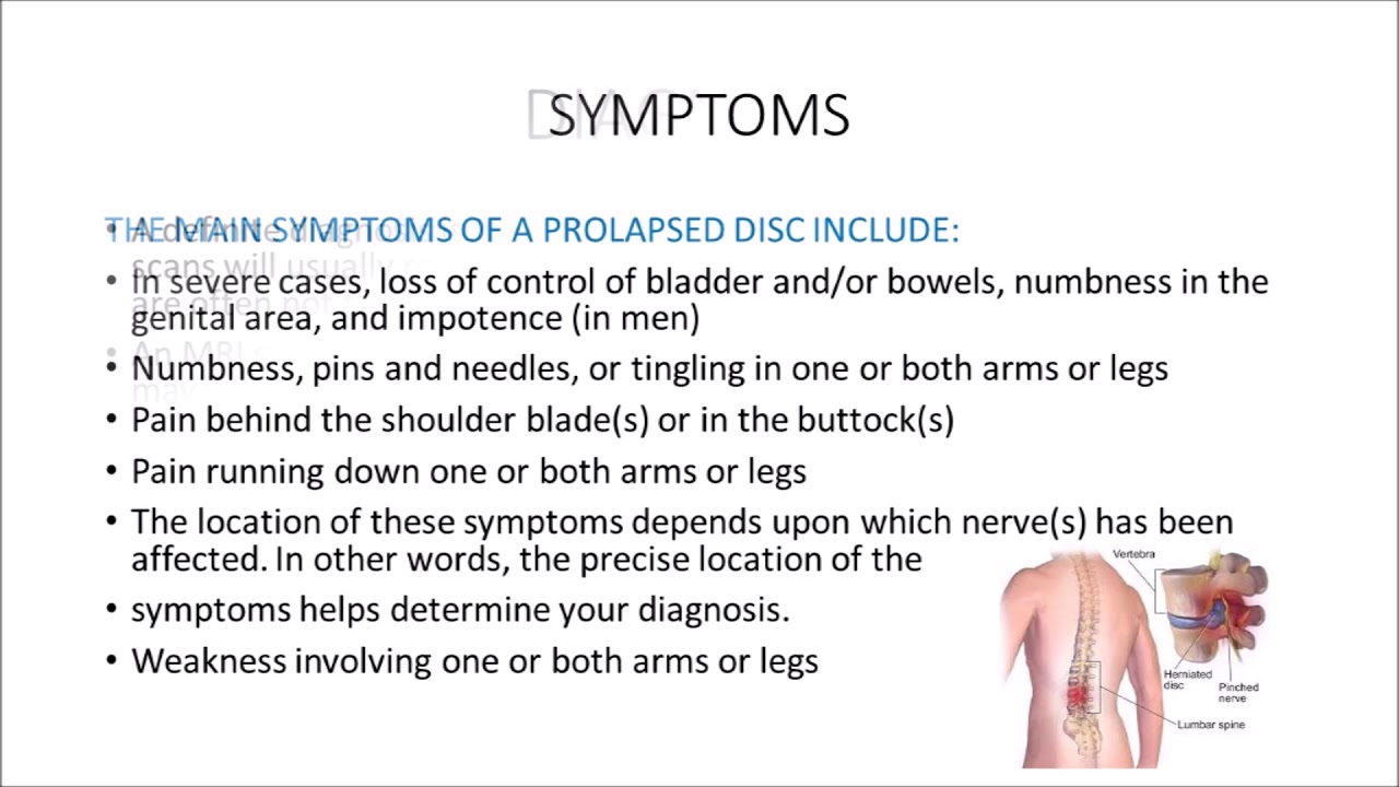 The best treatment IVDP In Ipoh - YouTube