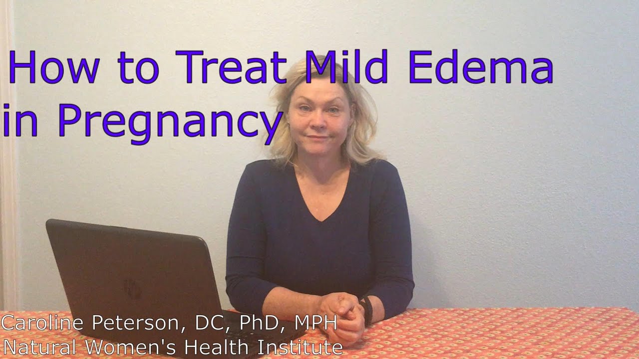 How to Treat Minor and Moderate Edema of Pregnancy - YouTube
