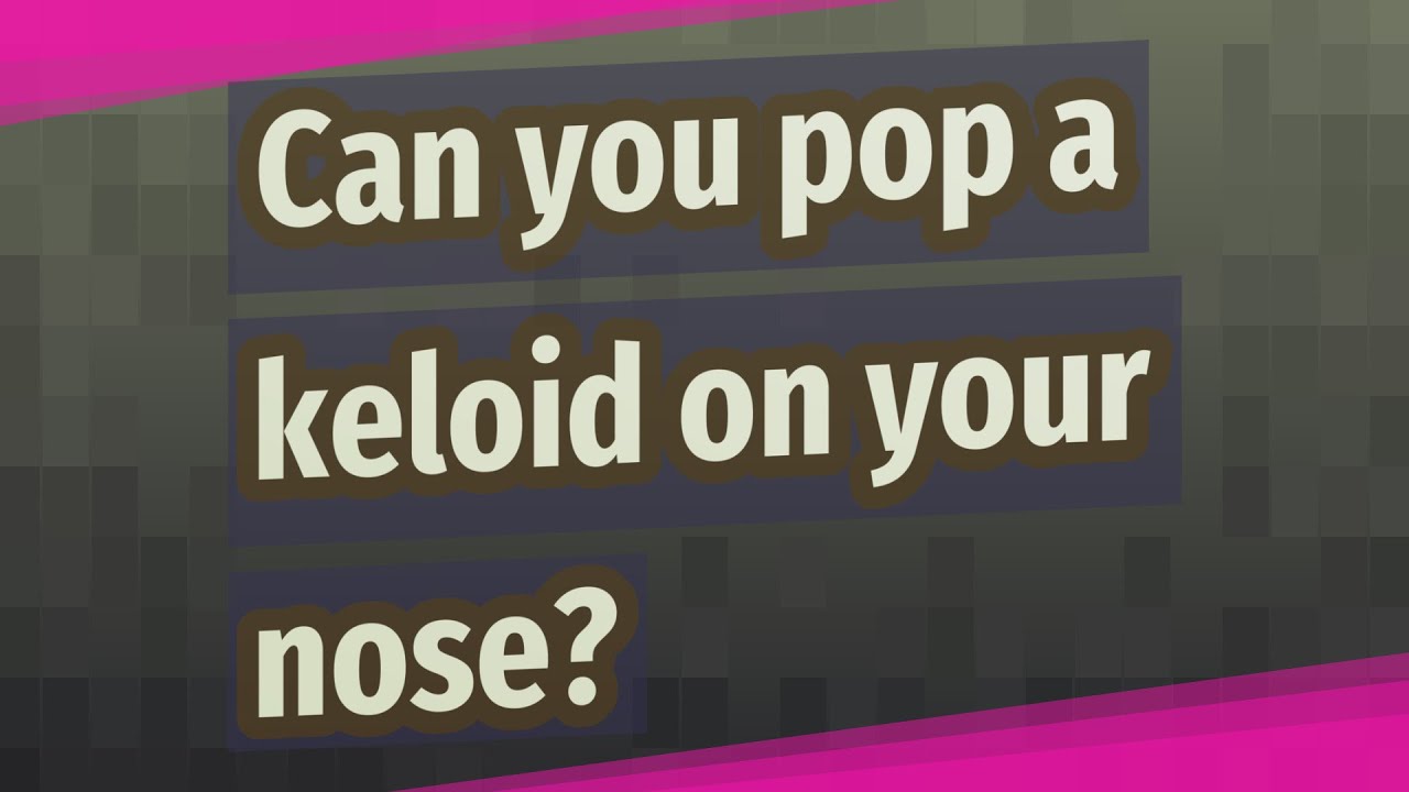 Can you pop a keloid on your nose? - YouTube