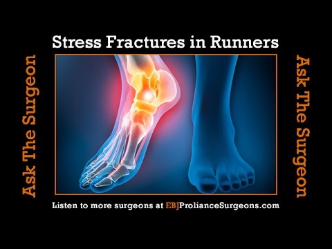Stress Fractures in Runners, What Surgeons Advise - YouTube
