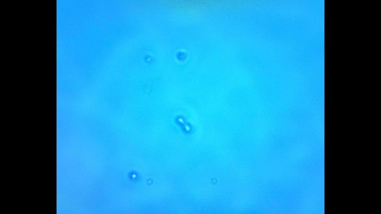 Kombucha Probiotic under Microscope going through Mitosis - YouTube