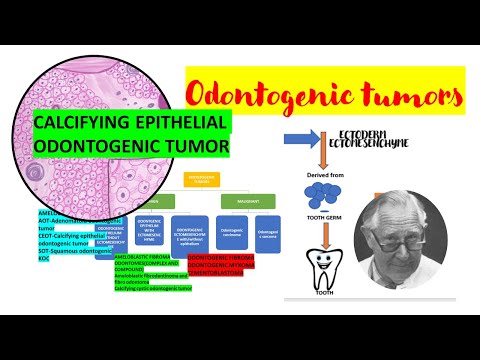 Calcifying epithelial odontogenic tumor (CEOT)DETAILED|Pindborg tumor |Tumors of odontogenic origin
