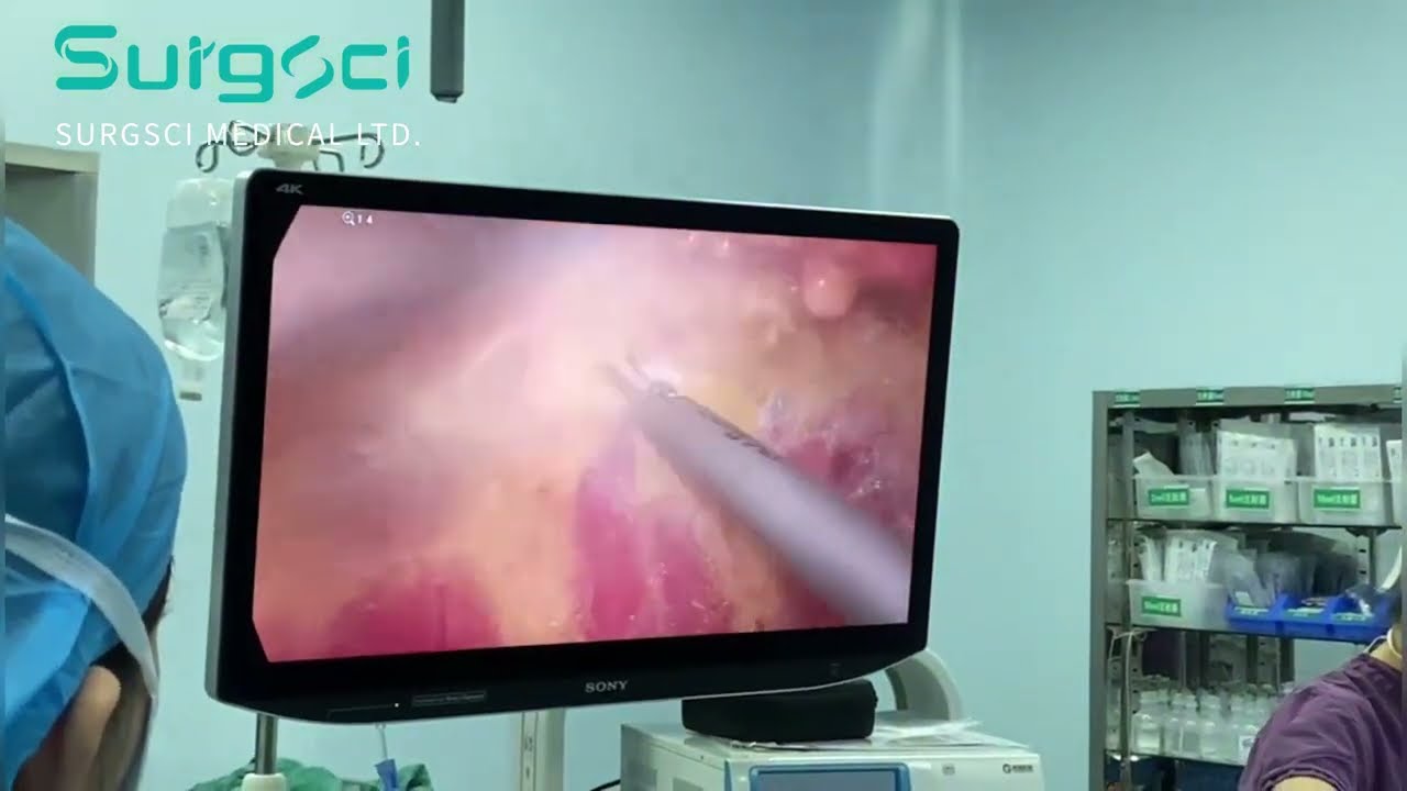 Ultrasonic Scalpel in Use | Laparoscopic bilateral thyroidectomy | Surgsci - YouTube