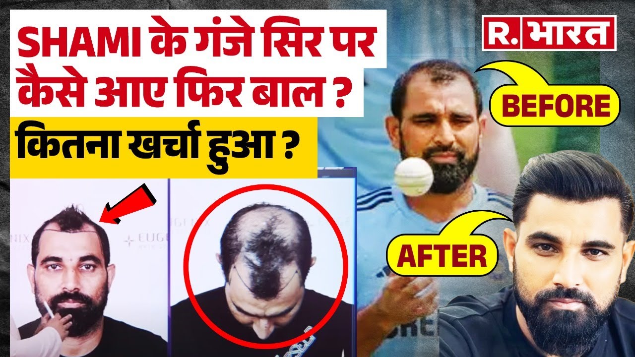 Shami ने New Look पर कितने पैसे खर्चे ? कैसे सिर पर फिर आए घने बाल ...