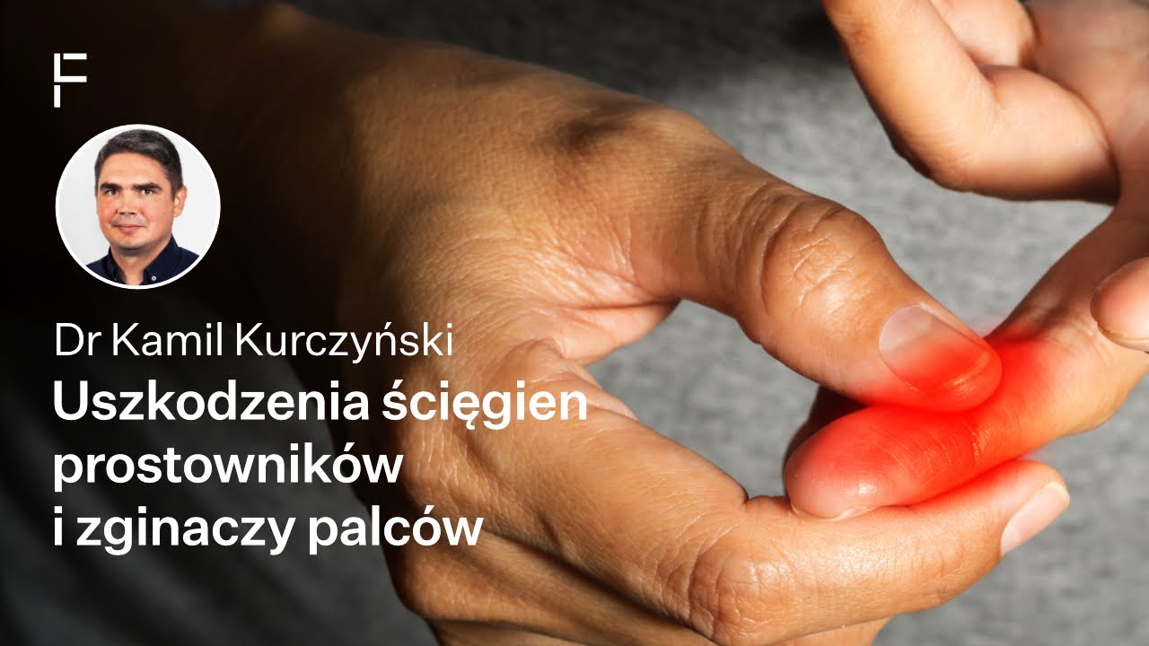 Uszkodzenia ścięgien prostowników i zginaczy palców – przyczyny ...