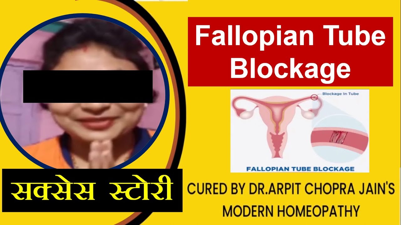 Female infertility fallopian tube blockage bilateral cured by Dr Arpit ...