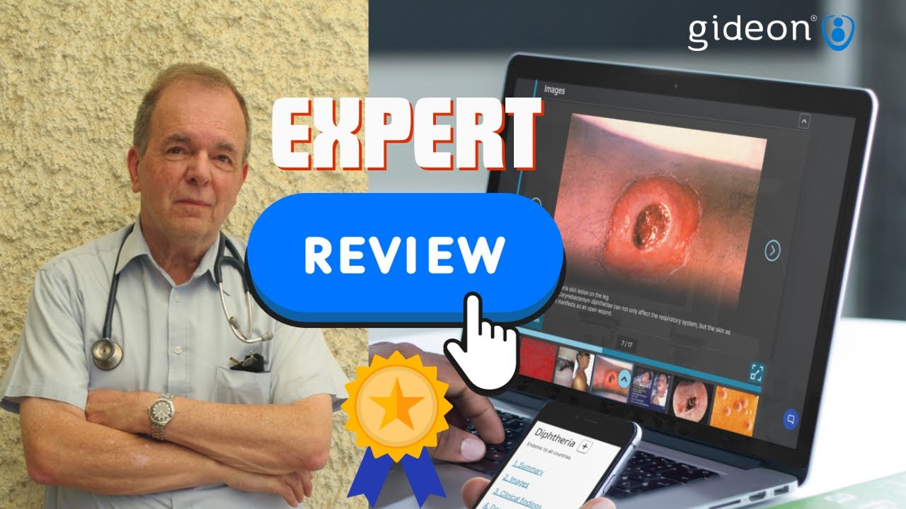 Dr. Stephen A. Berger Reviews GIDEON - YouTube