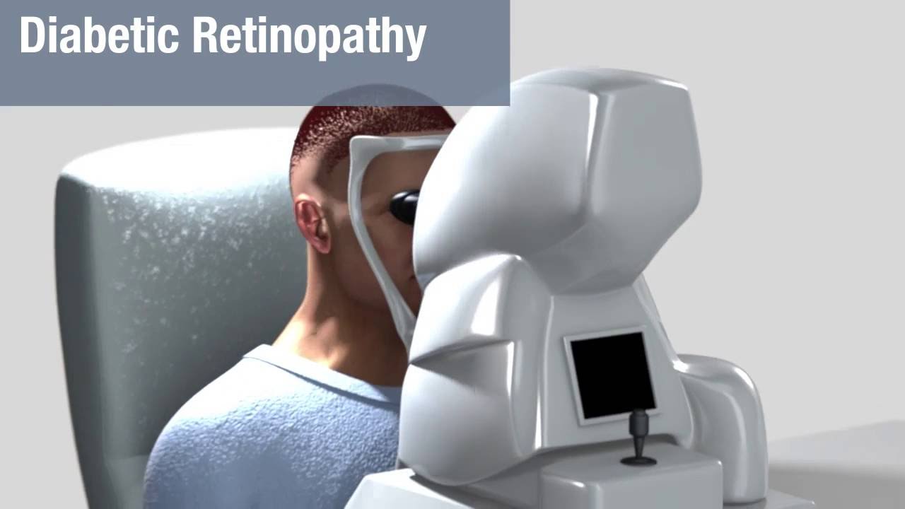 Diabetic Retinopathy Youtube