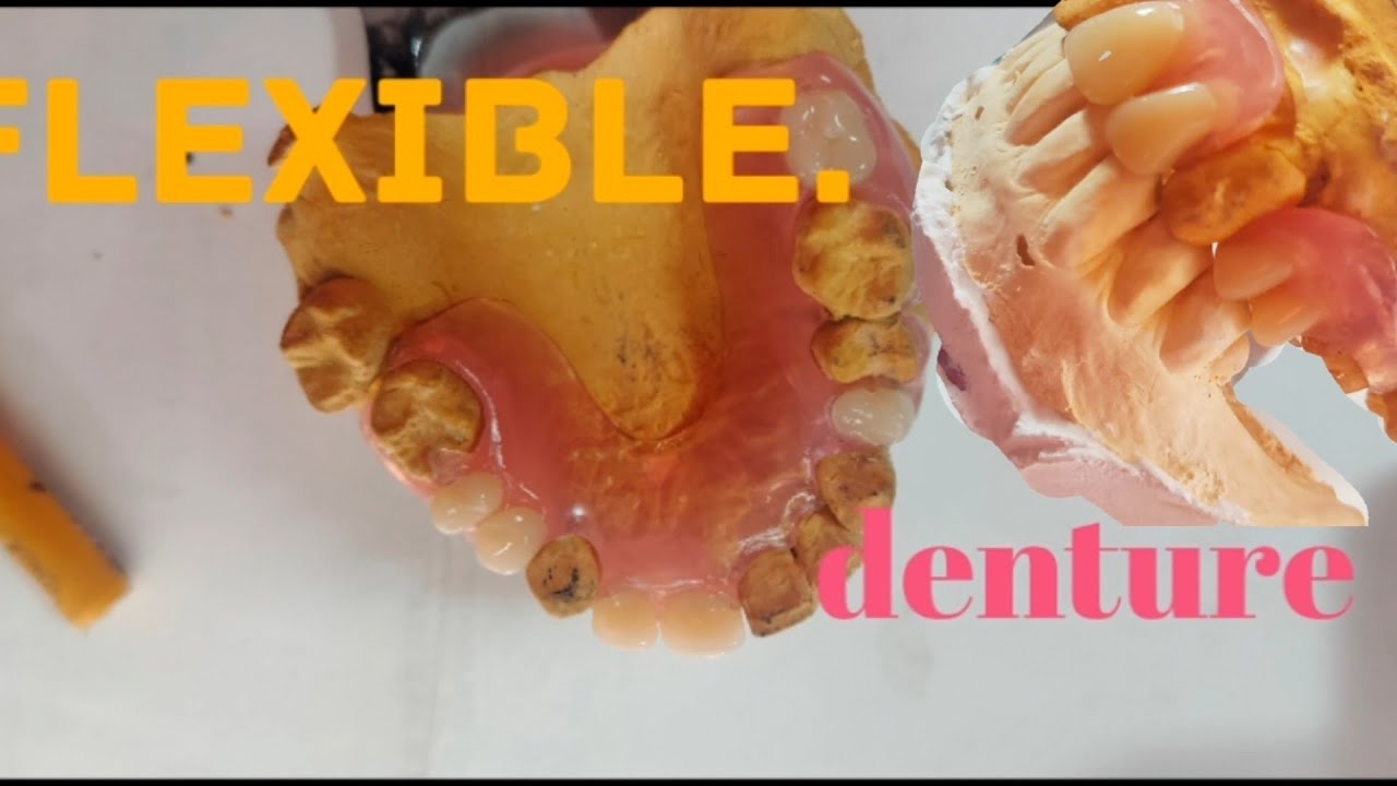 mahal na denture.flexible denture.o pustiso🥰 - YouTube
