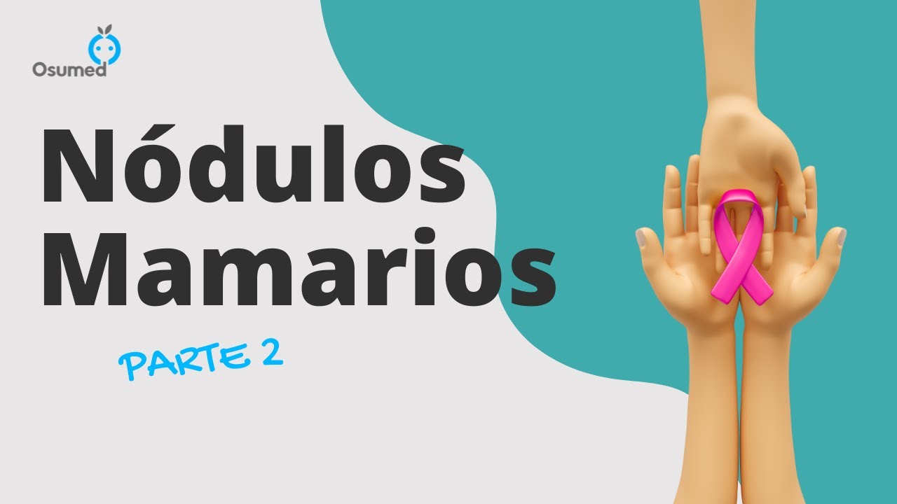 Entendiendo los nódulos MAMARIOS benignos: Una guía educativa para ...