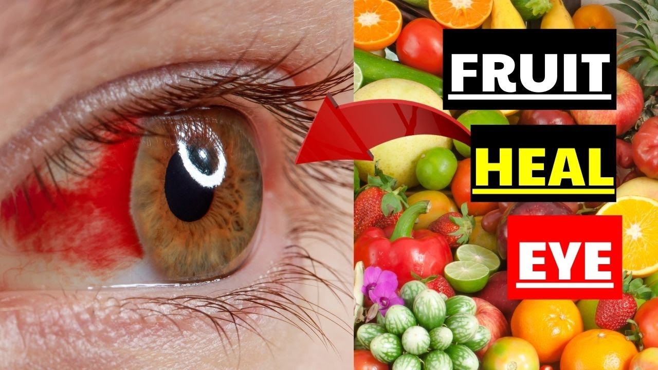 Top 10 Delicious Fruits That Sharpen Your Eyesight Naturally! - YouTube