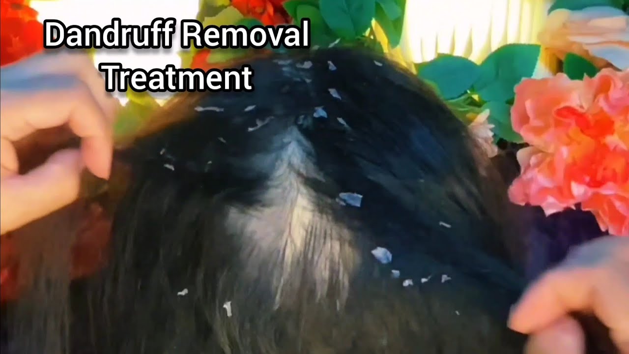 Asmr Dandruff Removal Treatment Scalp Scratching No Talking 😴💤🥱 Youtube