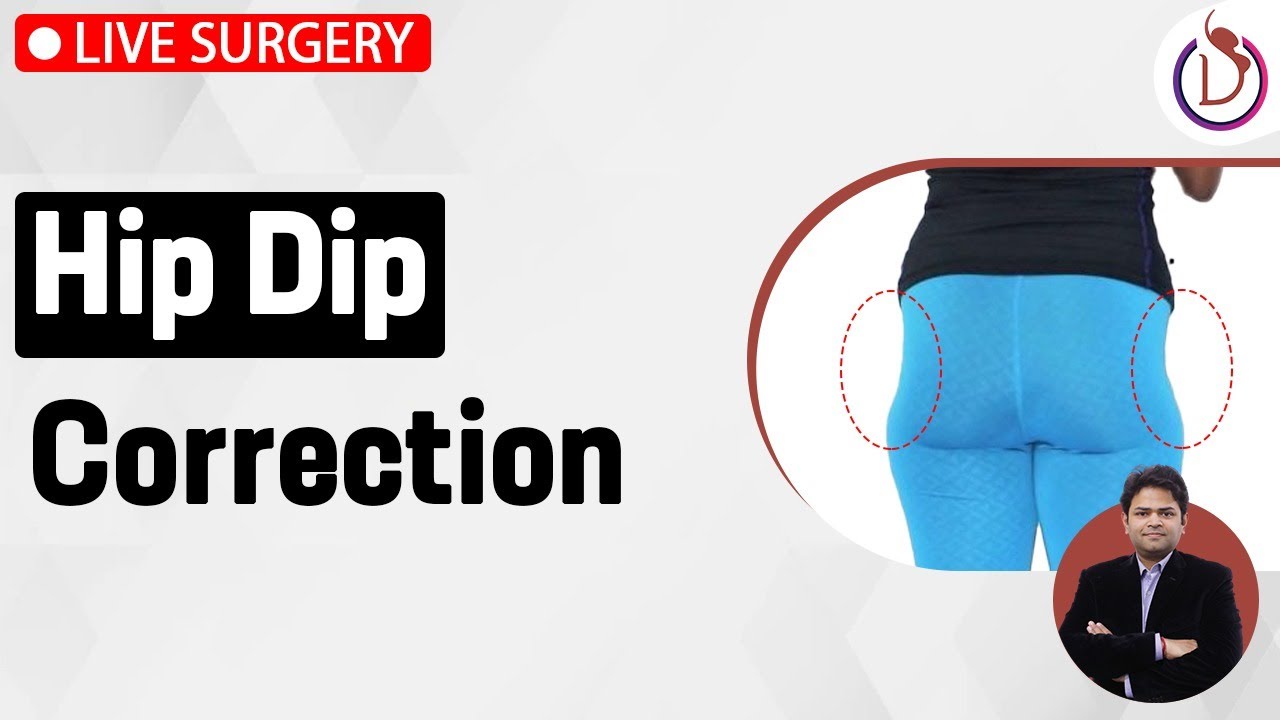 Hip Dip Correction Live - YouTube