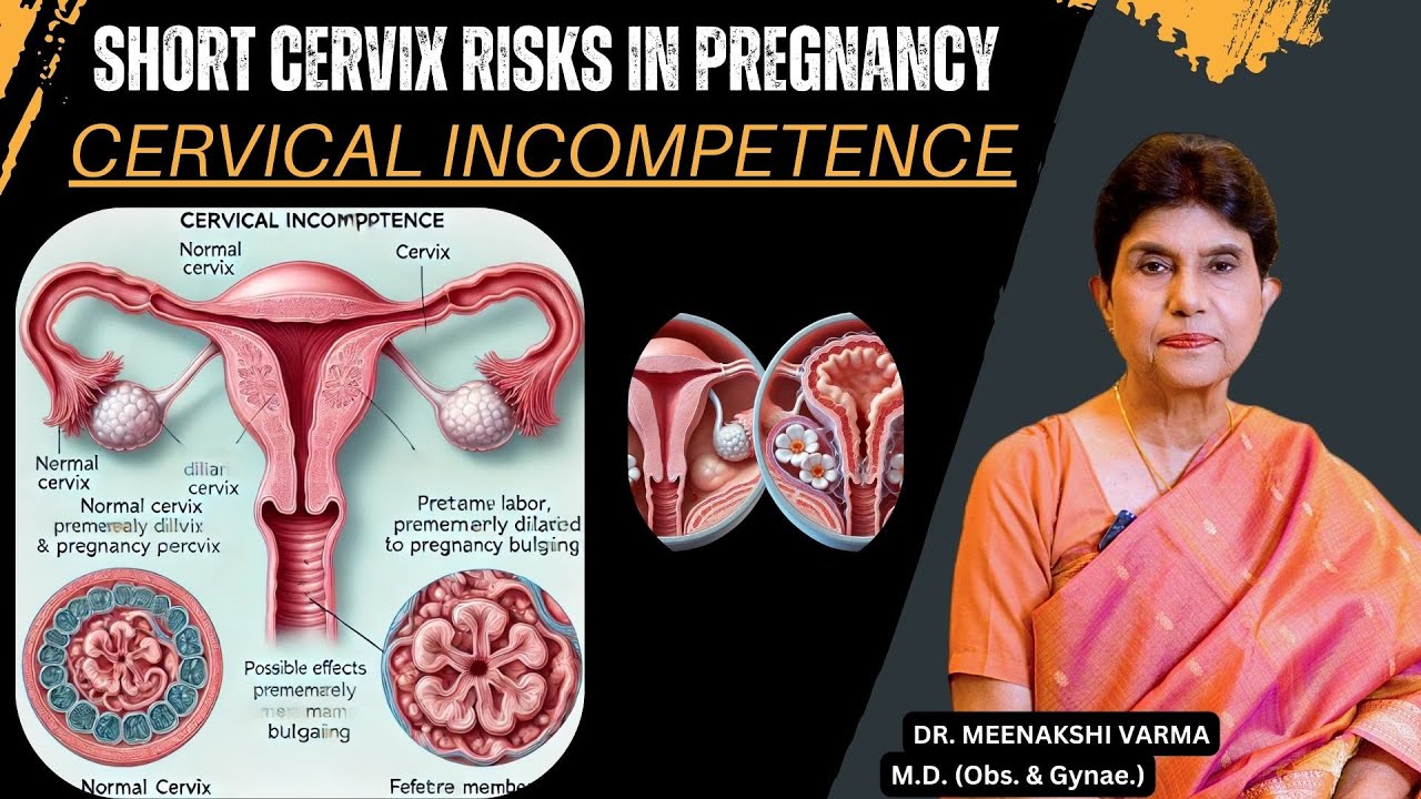 गर्भावस्था में सर्वाइकल इनकॉम्पीटेंस का खतरा | Cervical Incompetence ...