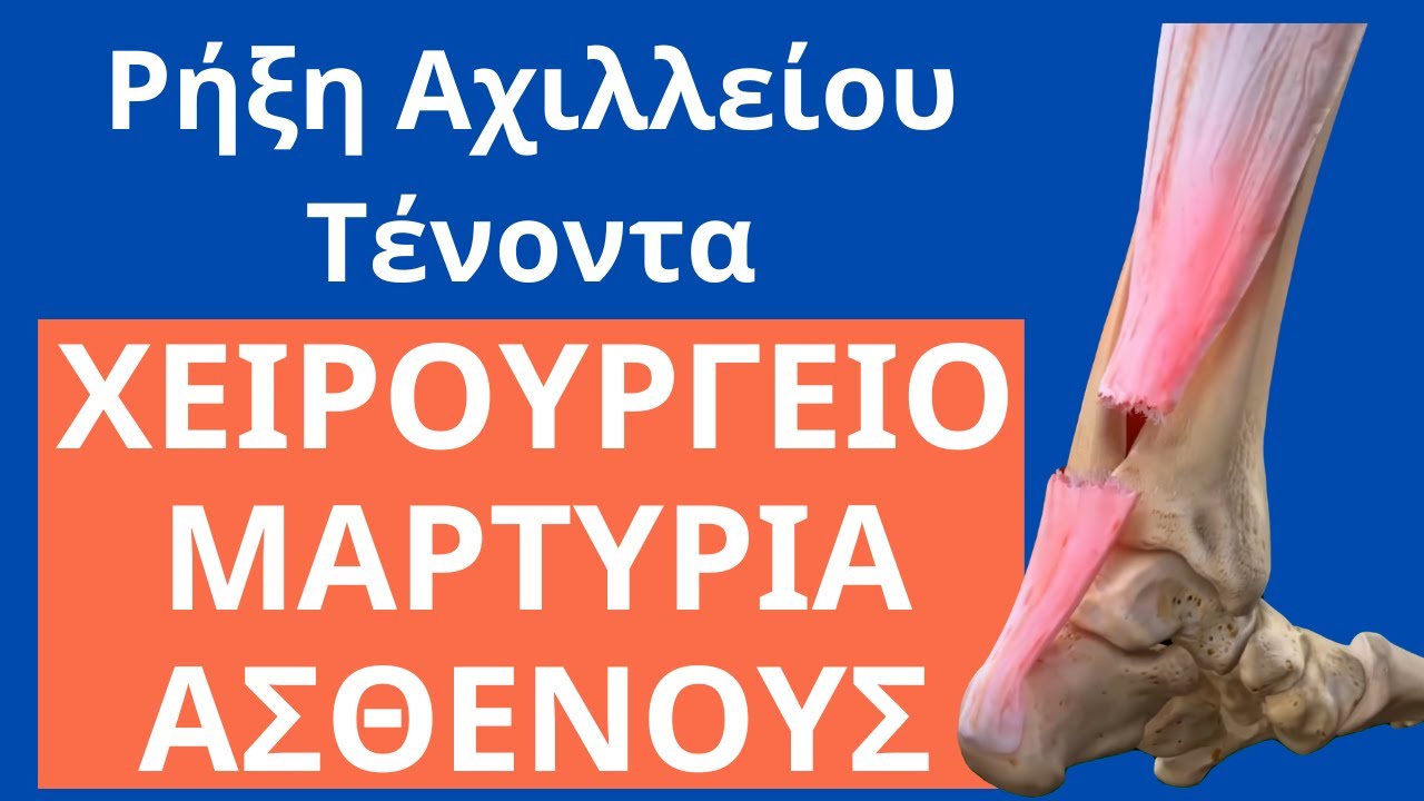 ΜΑΡΤΥΡΙΑ ΑΣΘΕΝΟΥΣ: ΧΕΙΡΟΥΡΓΕΙΟ ΓΙΑ ΡΗΞΗ ΑΧΙΛΛΕΙΟΥ ΤΕΝΟΝΤΑ # ...