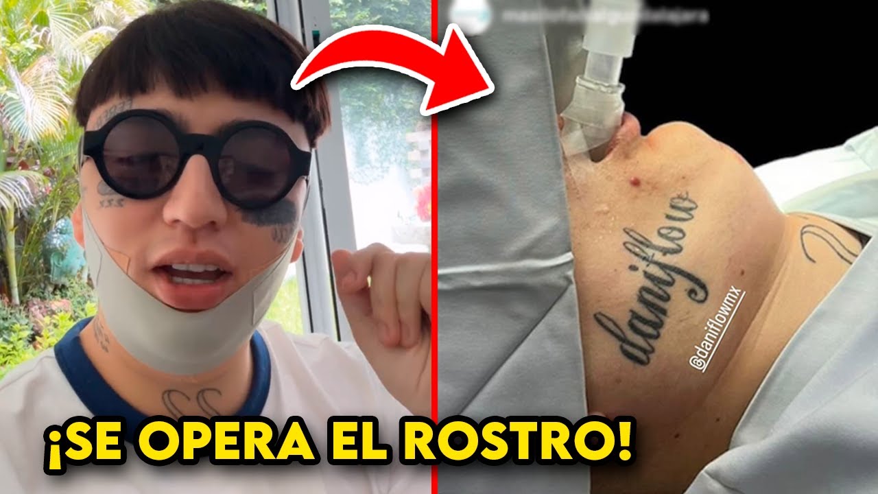 ¡Dani Flow se realiza OPERACIÓN en el ROSTRO! - YouTube