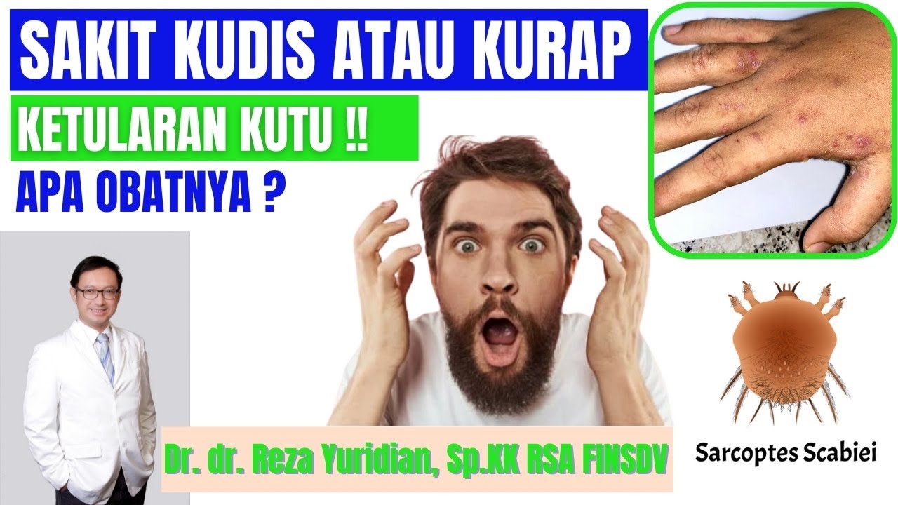 Penyakit kudis atau kudisan apa obatnya ? Apakah sama dengan sakit ...