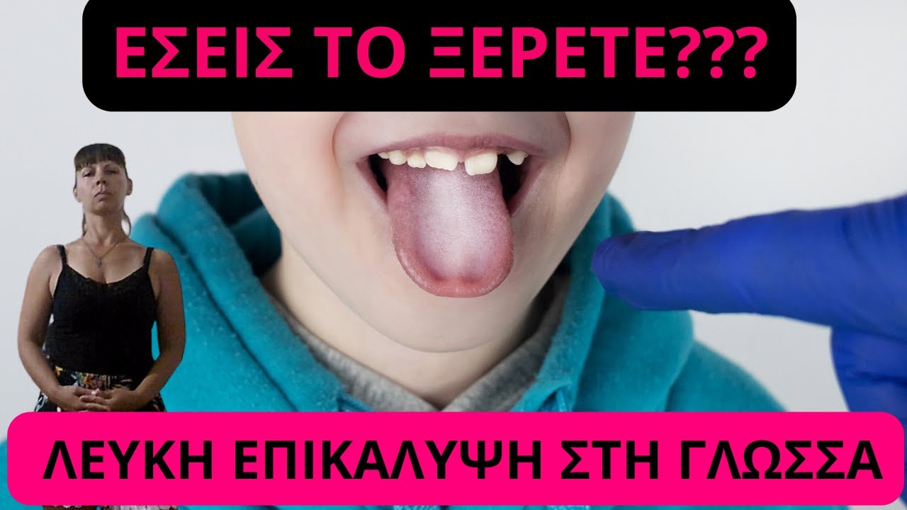 ΠΕΠΤΙΚΑ ΠΡΟΒΛΗΜΑΤΑ ΑΡΧΗΖΟΥΝ ΑΠΟ ΕΔΩ!!!ΑΙΤΙΑ ΚΑΙ ΛΥΣΗ!!! - YouTube