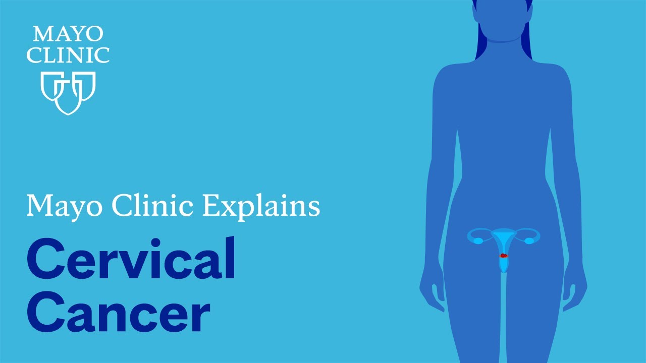 Cervical Cancer Causes And Risk Factors Cervical Cancer Causes And Risk Factors