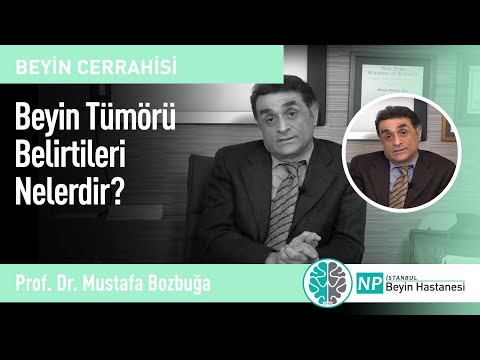 Beyin Tümörü Belirtileri Nelerdir