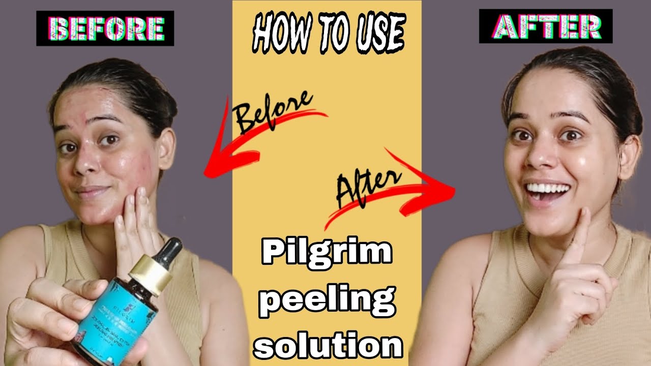 Pilgrim peeling solution how to use| Pilgrim peeling solution benefits ...
