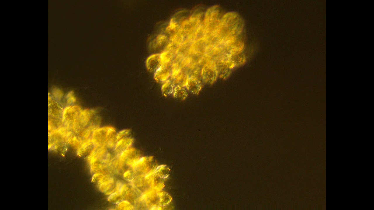 Blooms d’une microalgue, sur le Léman : Uroglena sp. non toxique, qui ...