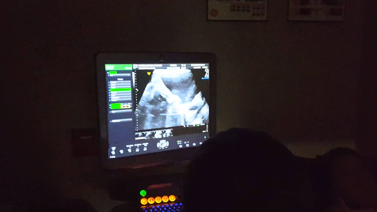 Keila's 27 weeks and 5 days ultrasound - YouTube