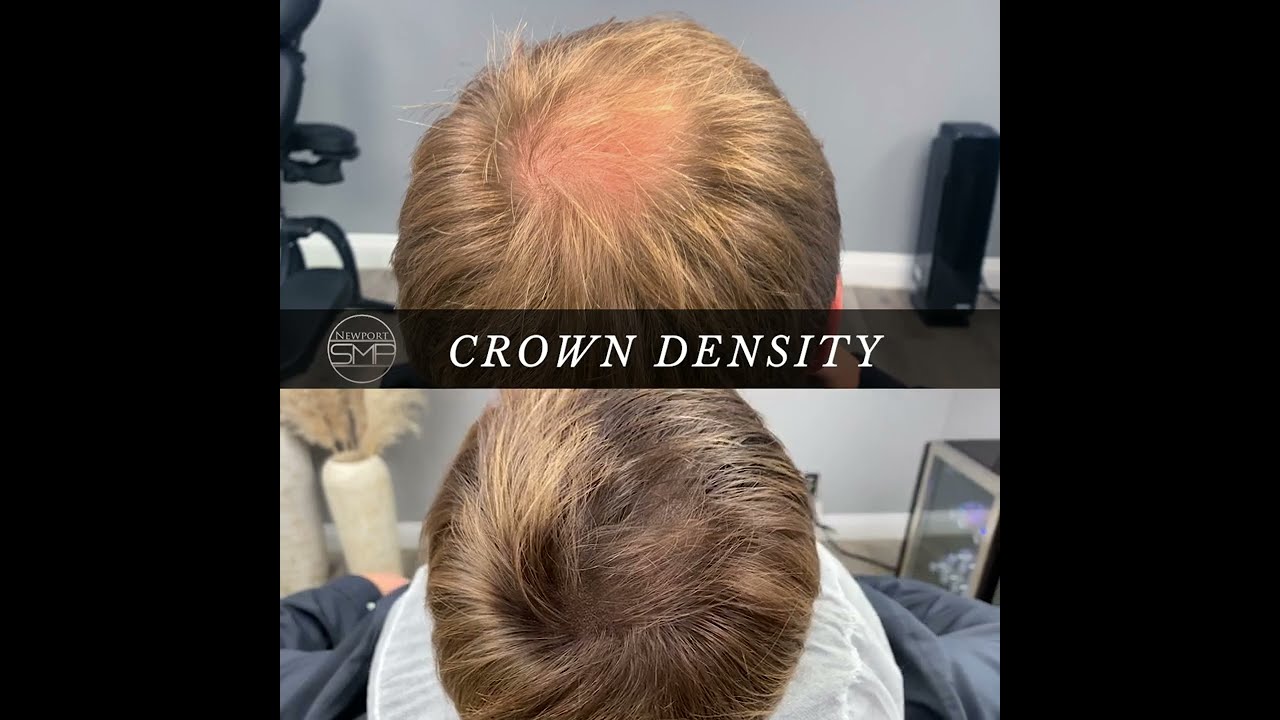 Crown Density SMP - YouTube