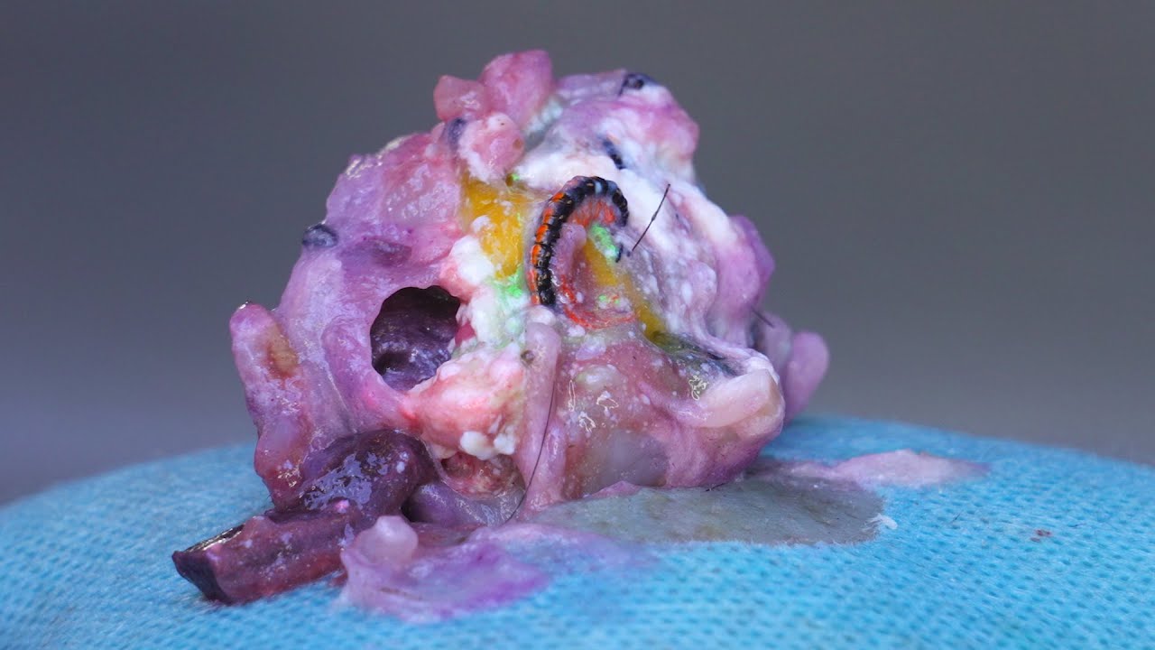 Dr. Lee Geoff Butler Enilsa MrPopZit 🌝 Professional pedicure process ...