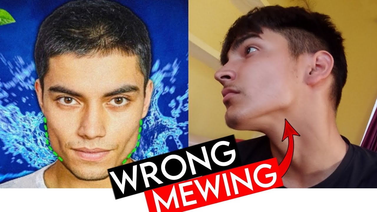 ALERT : WRONG MEWING IS KILLING YOUR LOOKS - YouTube