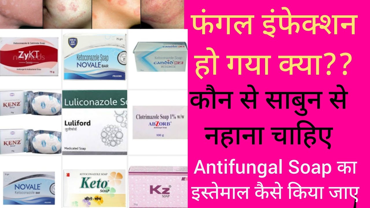Fungal Infection Series (PART 11) || फंगल इंफेक्शन होने से कौन सा Soap ...