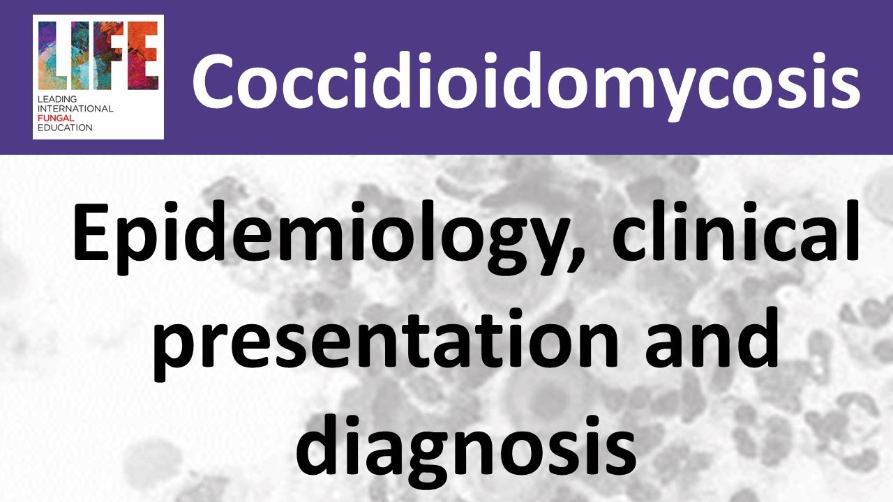 Coccidioidomycosis Epidemiology Clinical Presentation And Diagnosis Youtube