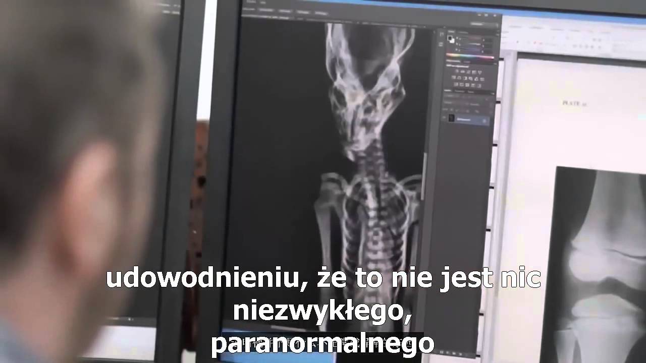 The Atacama Humanoid Mystery Part 2 - YouTube