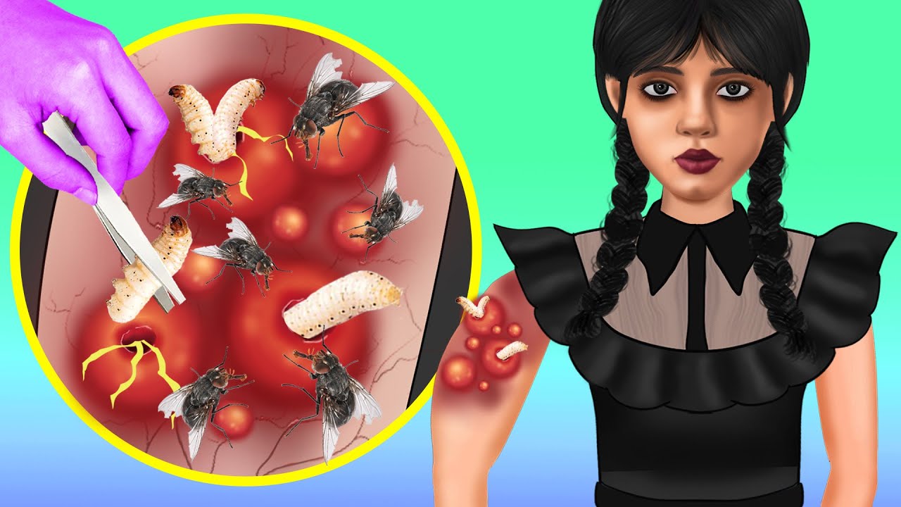 ASMR Treatment for Wednesday's arm injury | ASMR Animation - YouTube