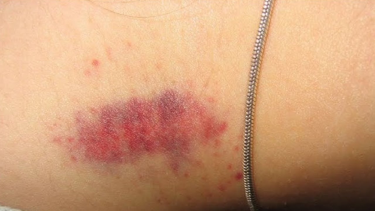 how to give a hickey in only 1 minute easy - YouTube