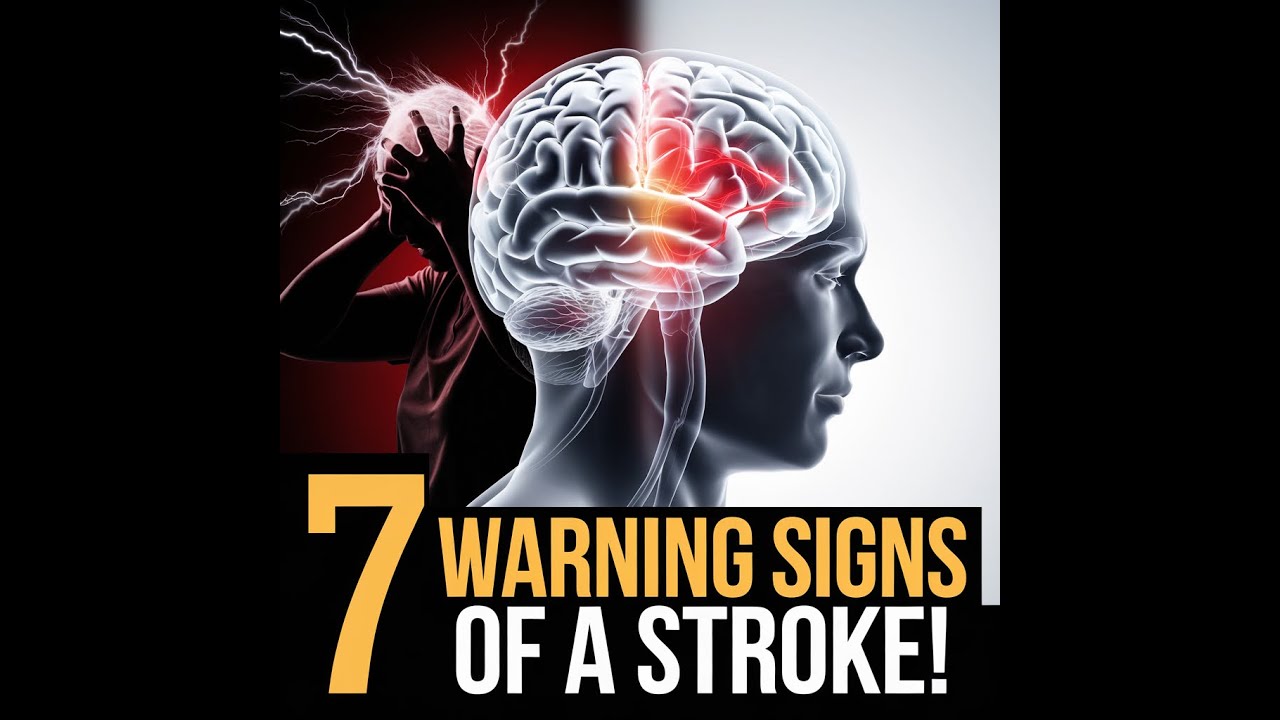 Recognize the Warning Signs of a Stroke Before It - YouTube