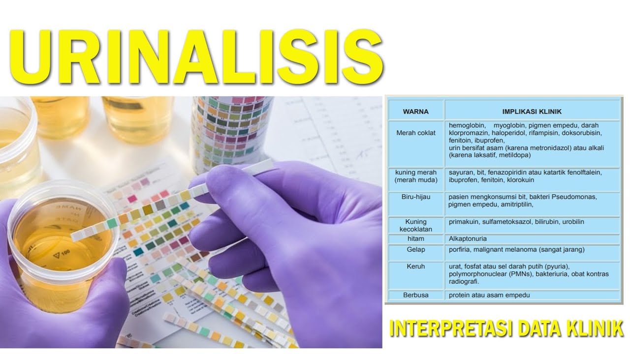 Interpretasi Data Klinik Urinalisis - YouTube