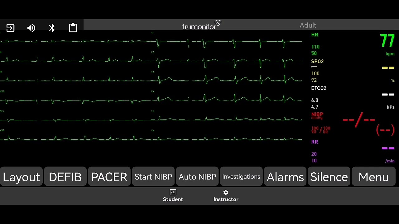 Normal Sinus Rhythm (12-lead ECG) - YouTube