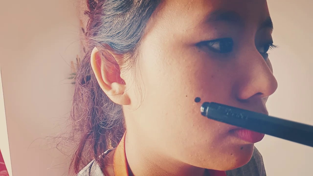 Facial Paralysis Treated by Acupuncture | Acupuncturist Dr Usha Ravi ...