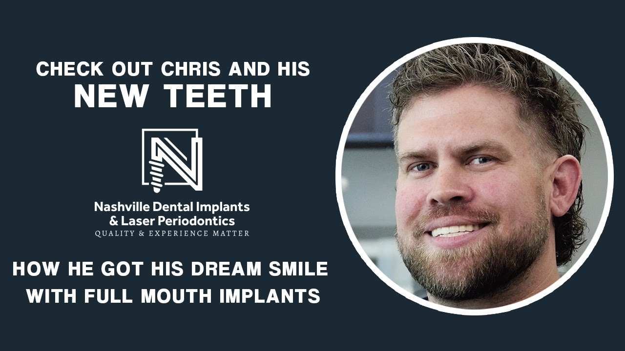 Chris's New Smile - YouTube