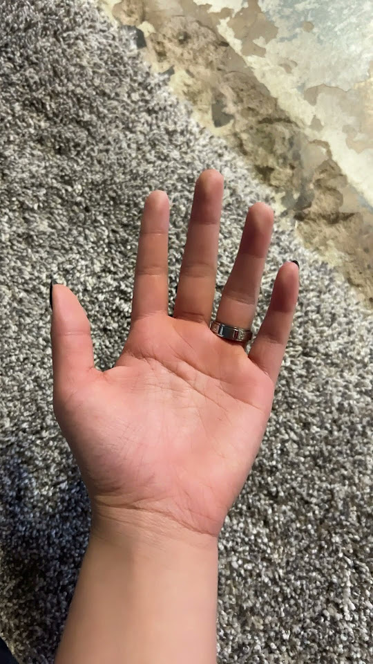 Why does my hand look like that💀😭🖤 - YouTube