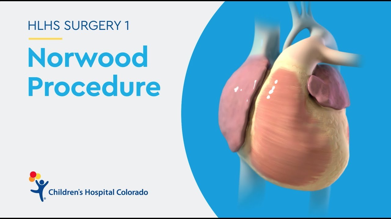What is the Norwood Procedure for Hypoplastic Left Heart Syndrome - YouTube